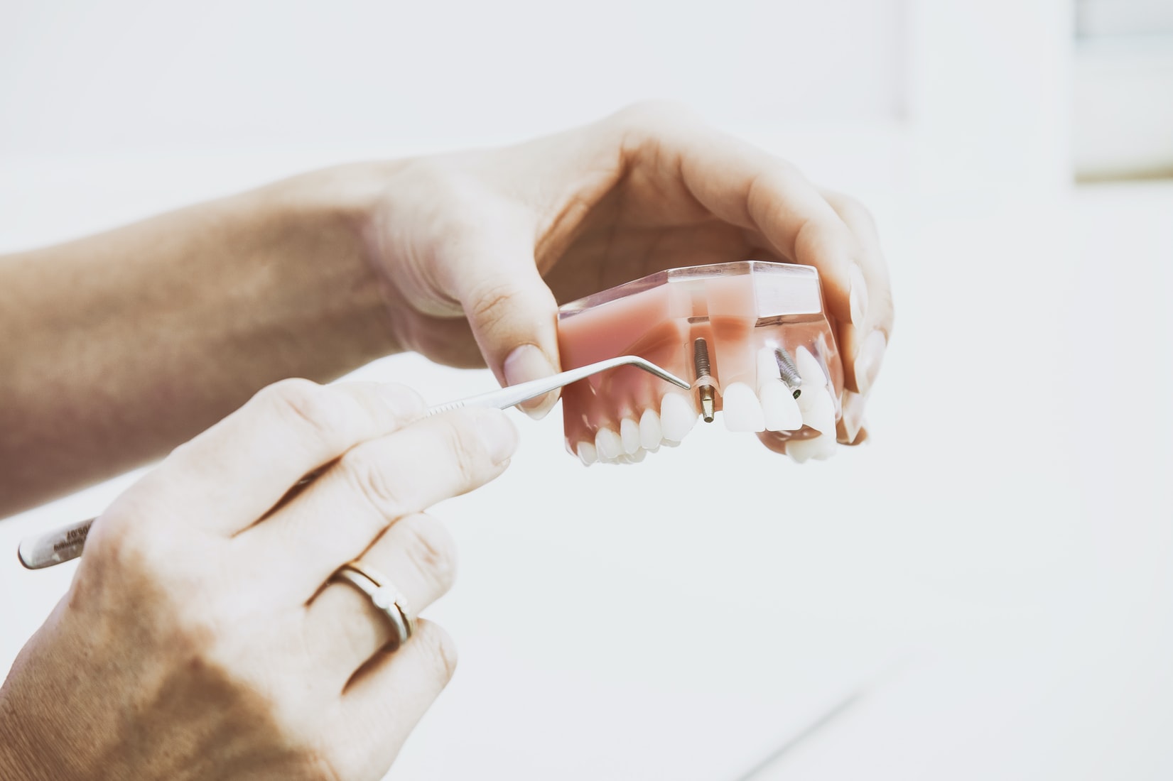 Understanding How To Effortlessly Identify A Cavity