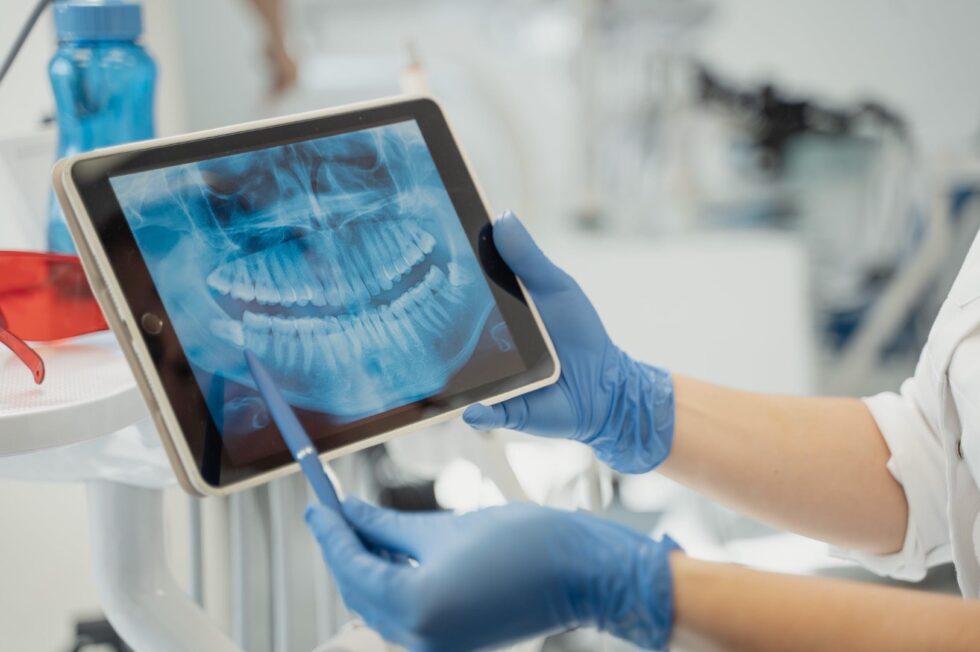 Getting A Better Understanding Of The Signs Of Dead Teeth