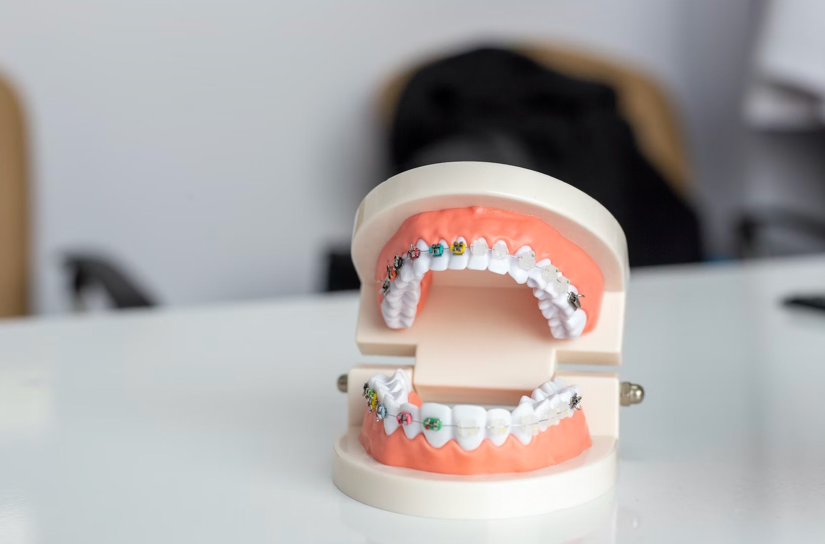 Clear Braces: What Are They and How Do They Work?