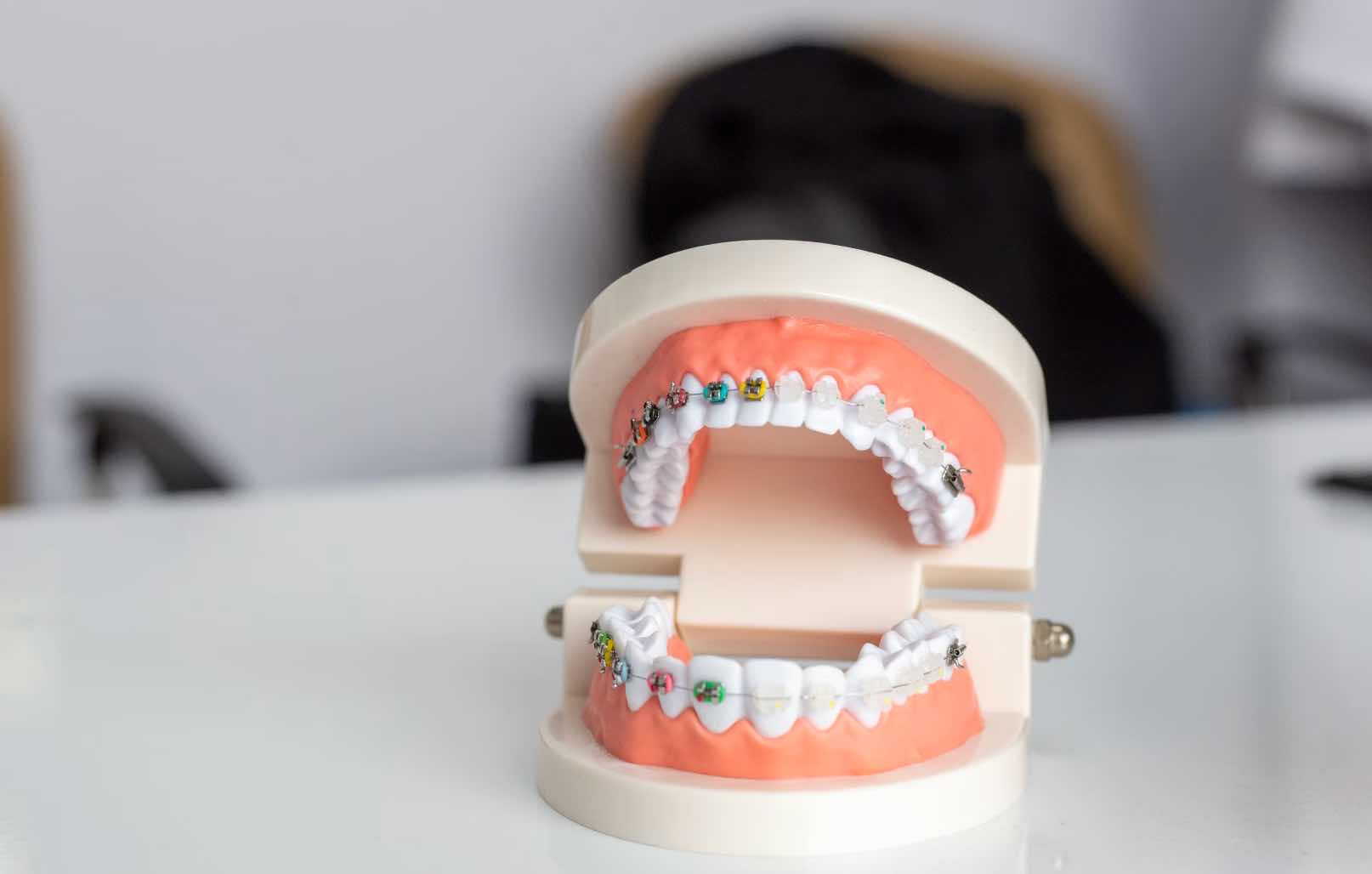 Best Ways to Deal with Holes in Your Teeth | Rancho Cucamonga Dentists